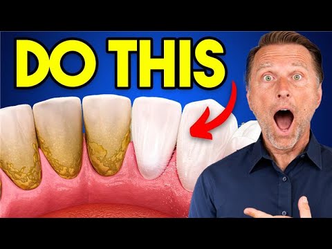 Unlock a Natural Toothpaste Recipe to Fight Plaque and Tartar ...